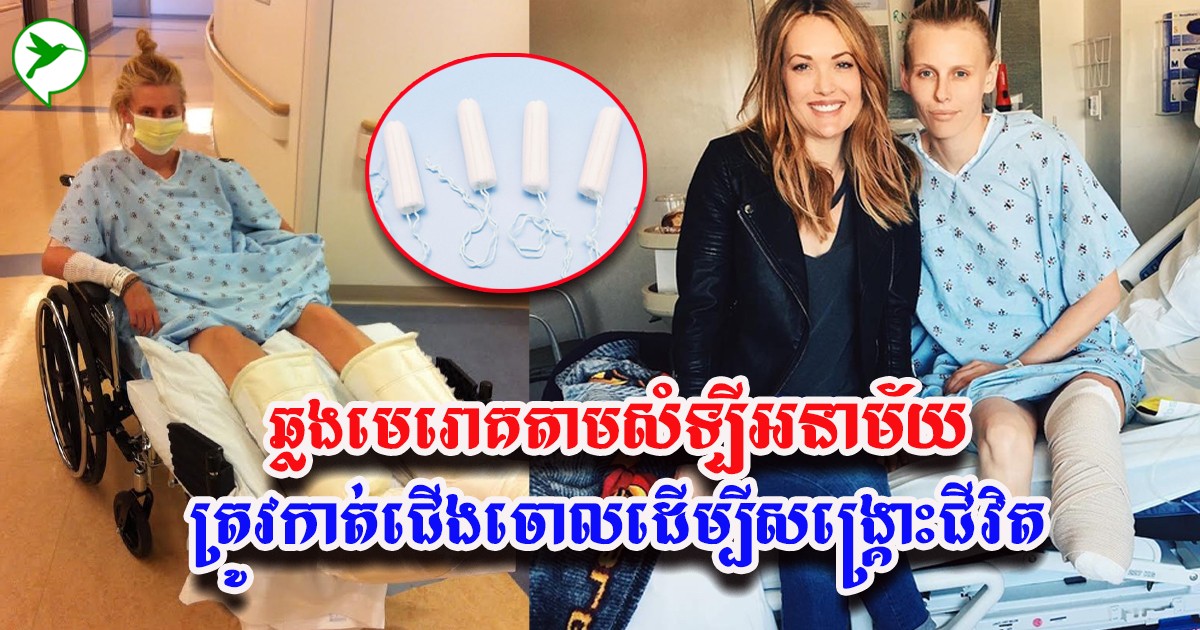ជំងឺឆ្លងតាមសំឡីអនាម័យ ធ្វើឱ្យតារាម៉ូឌែលស្រី ...