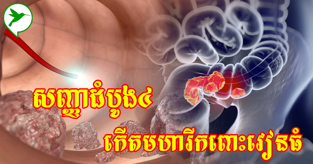 វេជ្ជបណ្ឌិតធំៗ បង្ហើបថា រកសញ្ញាដំបូងបំផុតទាំង៤នេះ ...
