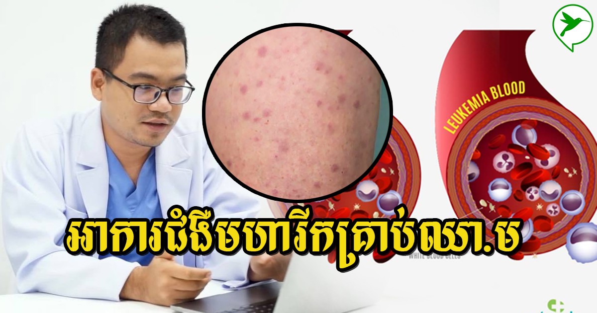 រោគសញ្ញា និងវិធីទប់ស្កាត់ ជំងឺឈាមសស៊ីឈា.មក្រហម គួរពិនិត្យបន្ទាន់ ...